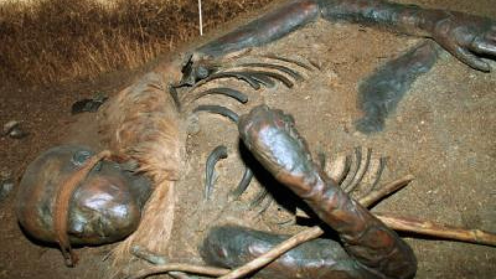 Moorleiche «Mädchen von Windeby» in Wahrheit ein «Windeboy»