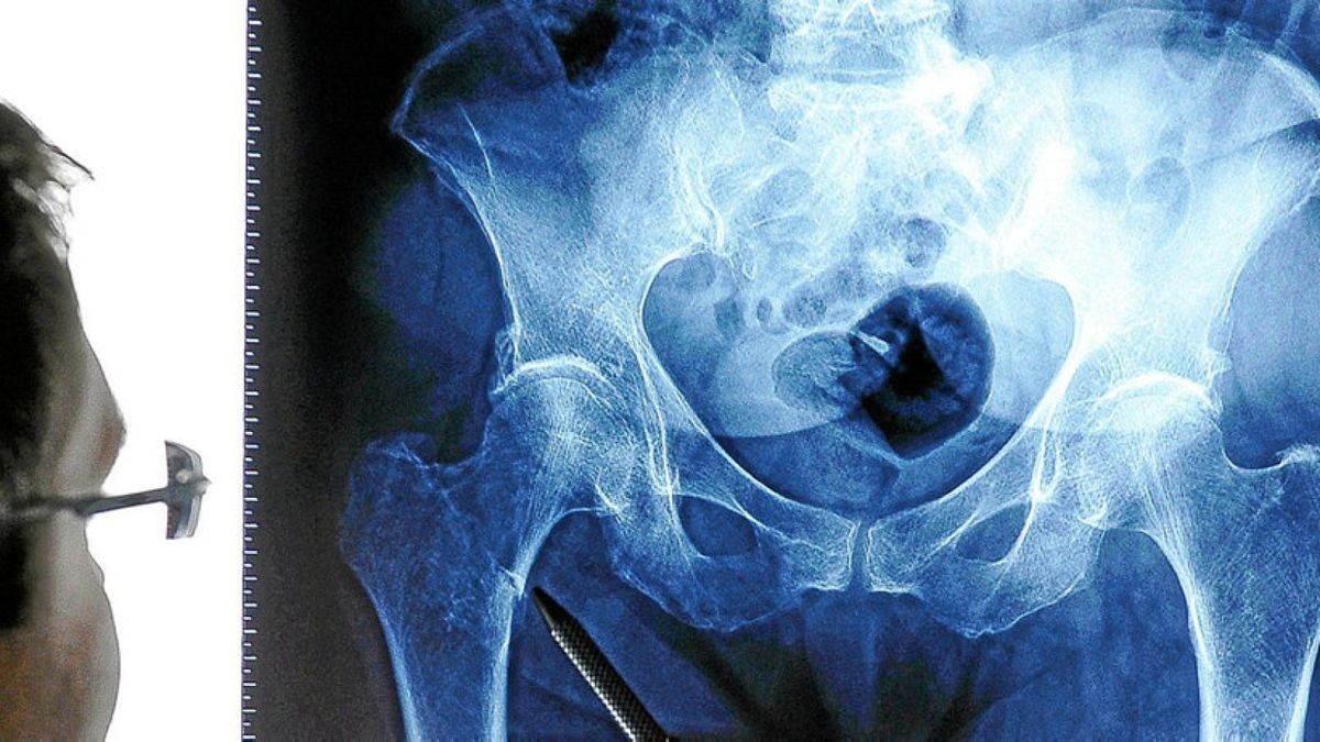 Thüringer Röntgen-Bus für Flüchtlinge nun bei Justiz im Einsatz