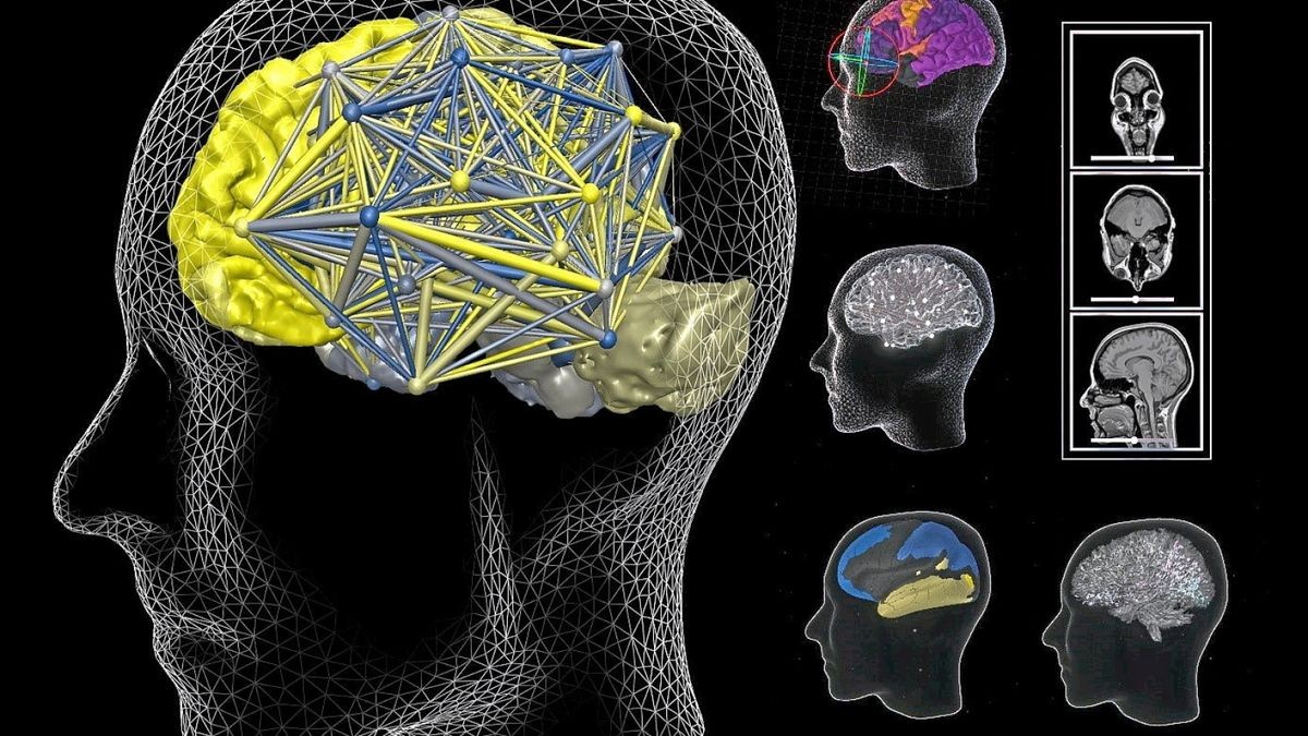 Die exakte Kopie des Gehirns entsteht am Computer