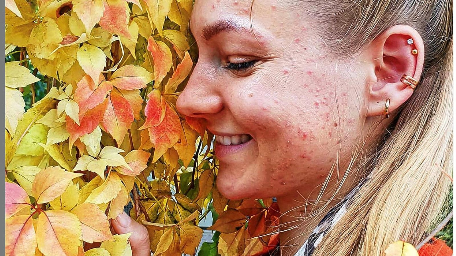 Diese Insta-Stars zeigen, dass man nicht perfekt sein muss