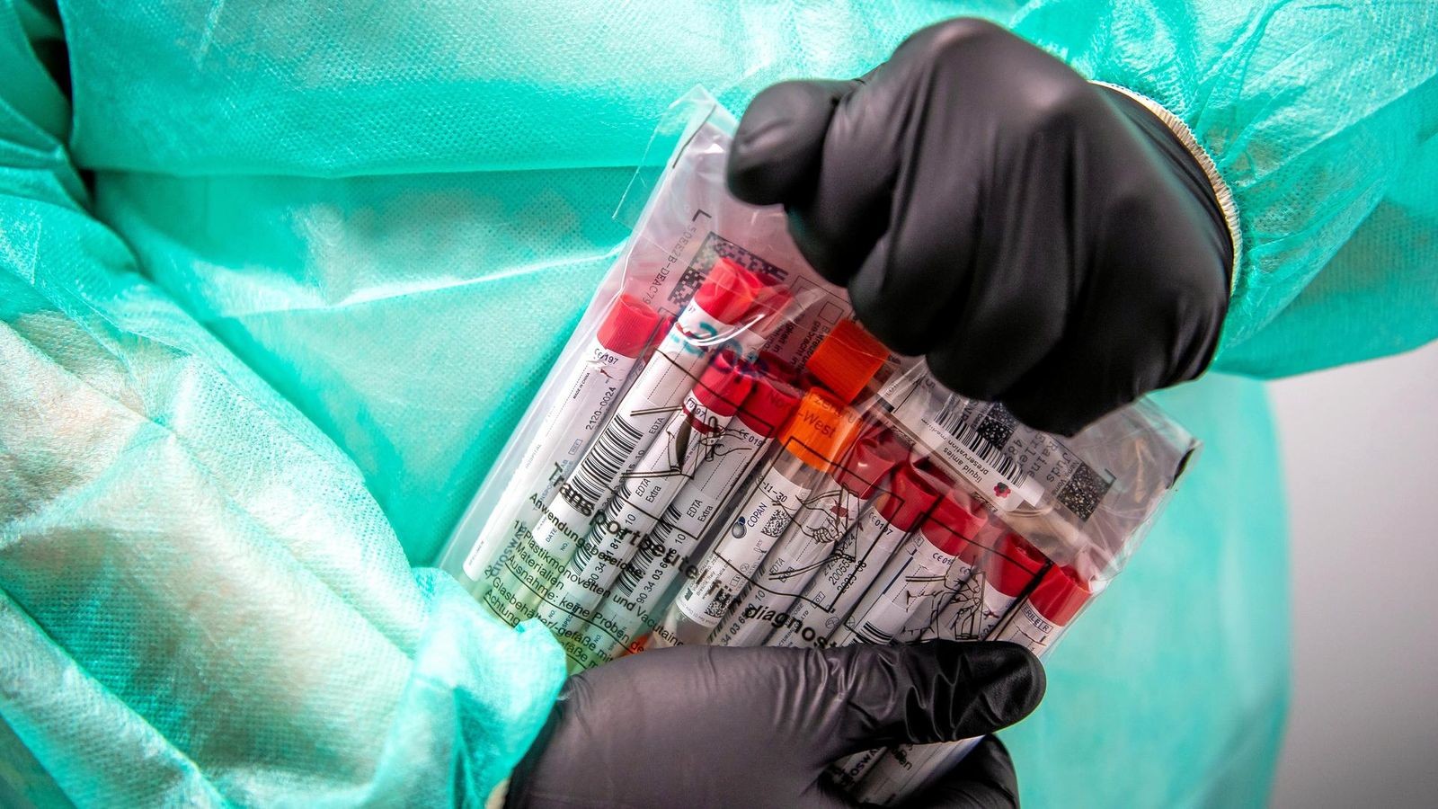 Weitere Fälle der Eta-Mutation im HSK-Nachbarkreis Paderborn