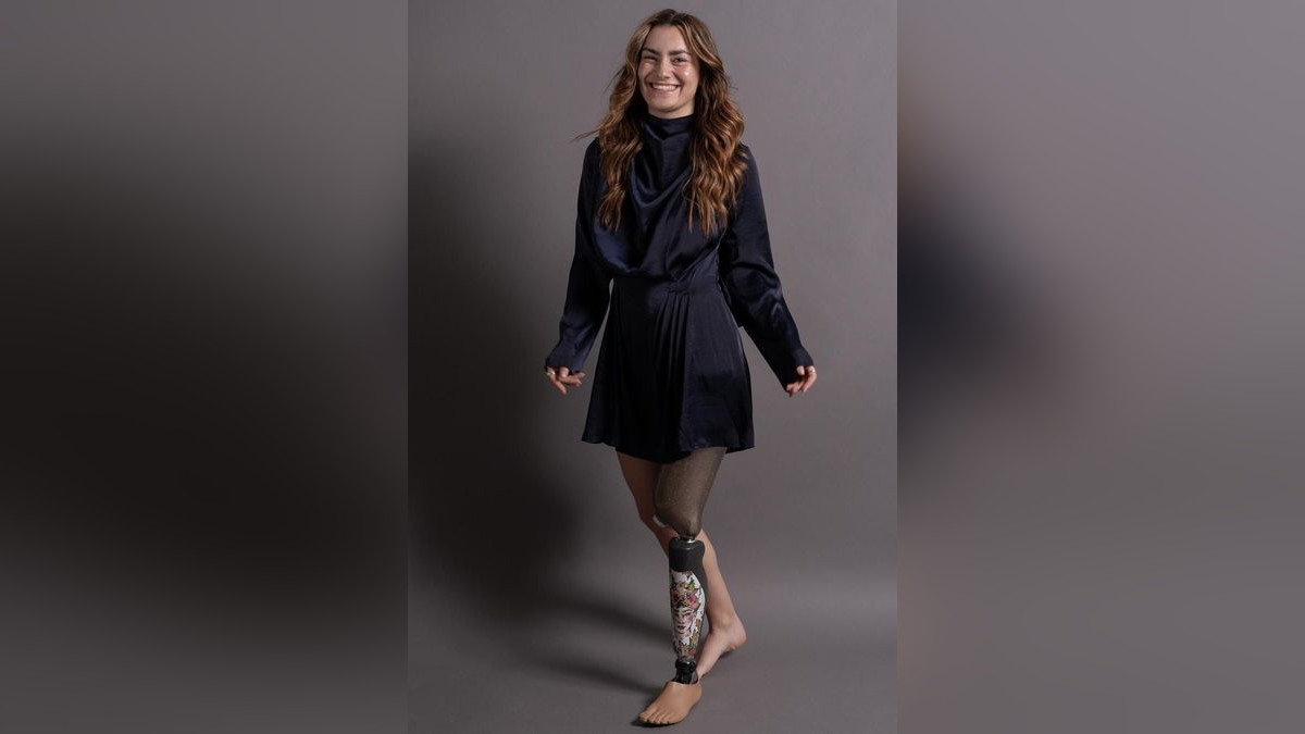 „Woodwalkers“-Schauspielerin mit Beinprothese: „Besser wird’s nicht mehr“