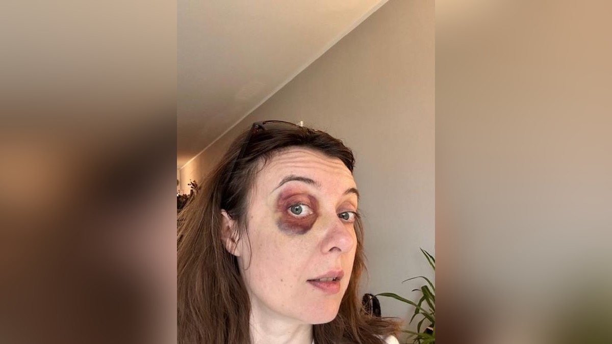 Schock-Angriff in Hamburg: Mann schlägt 41-Jähriger in St. Georg ...